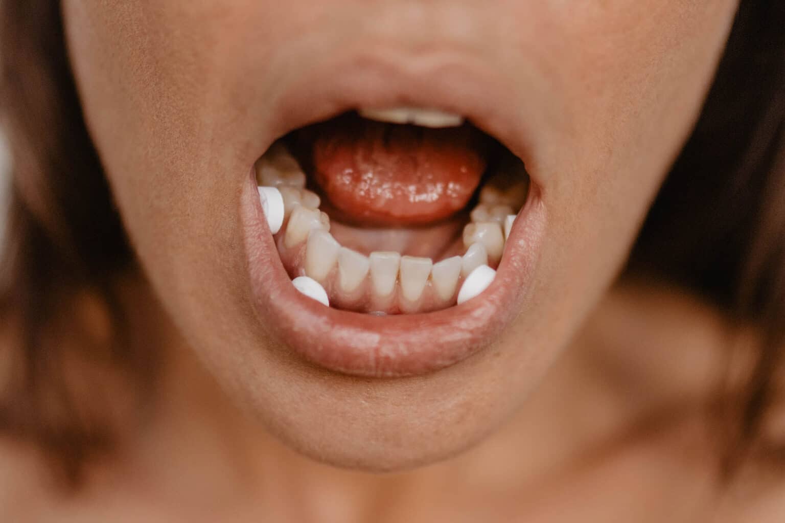 How To Insert Misoprostol: Vaginal, Sublingual Or Buccal? | Self Guided ...