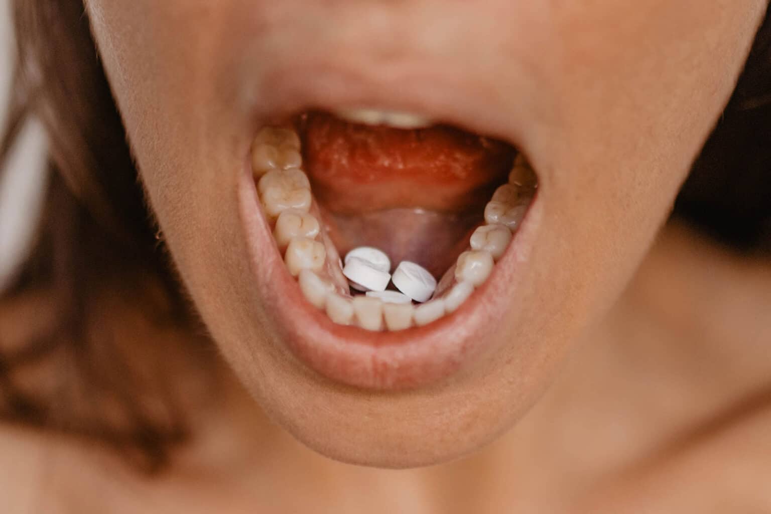 How To Insert Misoprostol: Vaginal, Sublingual Or Buccal? | Self Guided ...